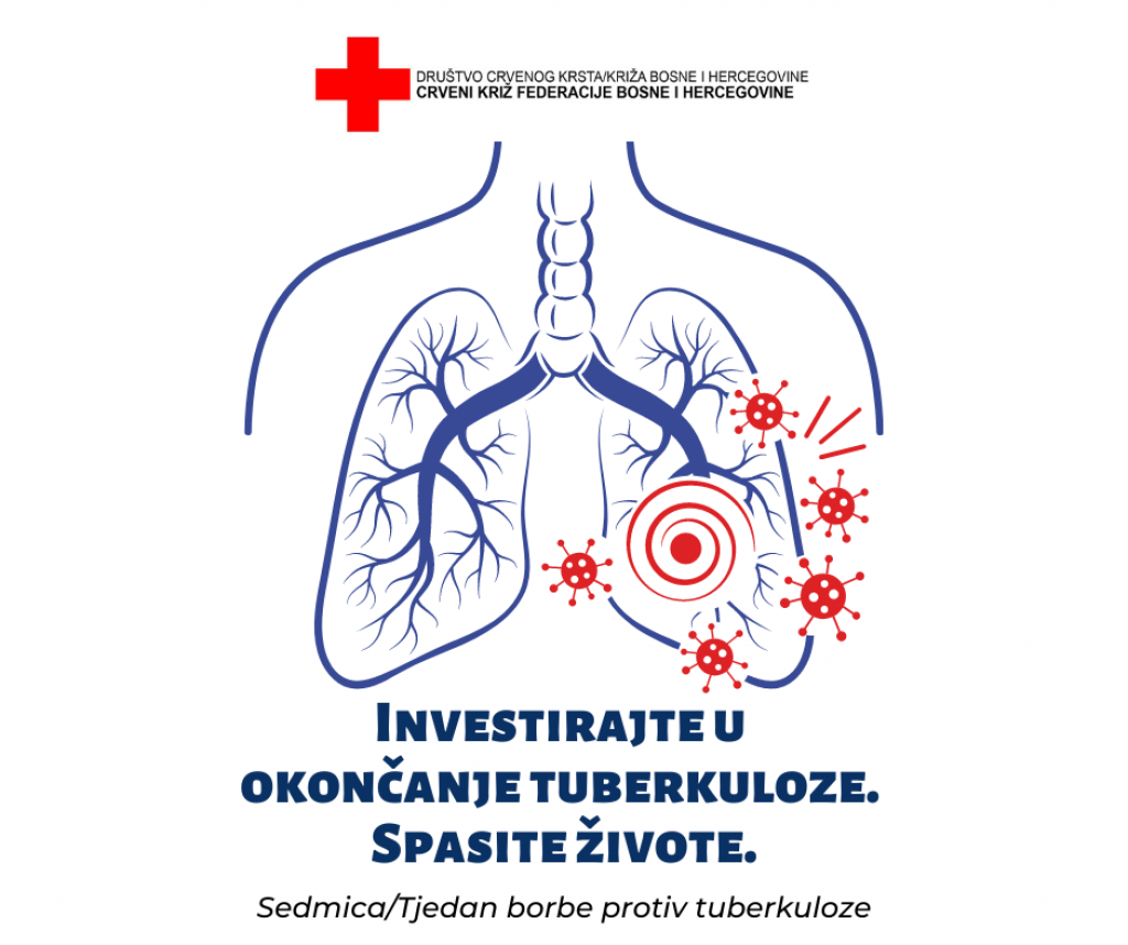 Crveni križ FBiH: Tuberkuloza ostaje jedan od najsmrtonosnijih zaraznih ...